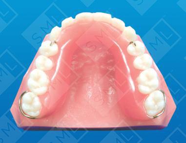 Horseshoe Temporary Partial,Interim Partial,Dental Tools | SML | Midwest